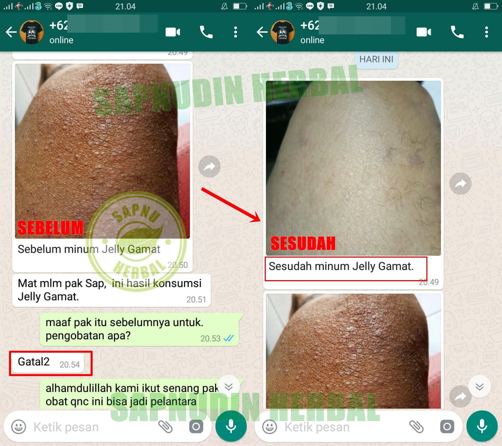 Ternyata Inilah Obat Darah Manis Paling Ampuh Yang Pernah Ada, Terbukti ...