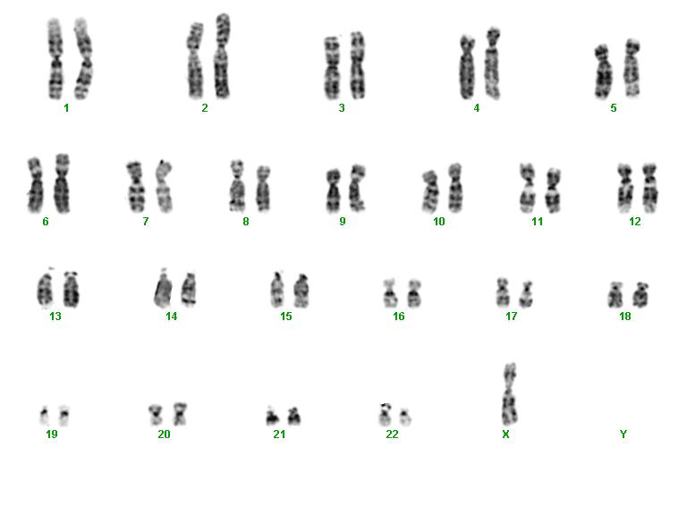Biología y geología : Mutaciones cromosómicas: observación de ...