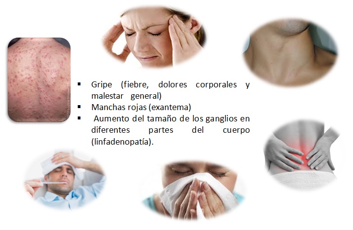 Enfermedades Causadas Por Microorganismos: VIH (VIRUS)