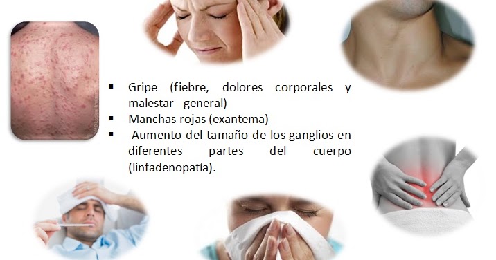 La Realidad del VIH en Nuestro Pais