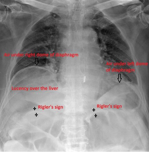 ความรู้เรื่อง plain film