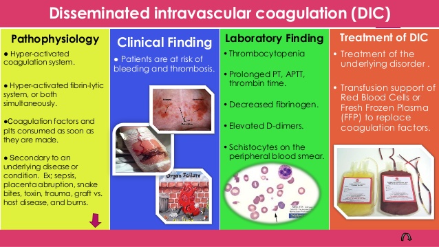DIC (Disseminated Intravascular Coagulation)