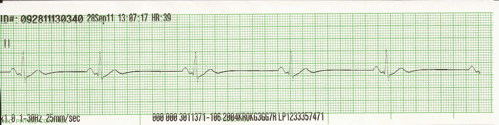 Identify the appropriate electrical intervention for the following EKG ...