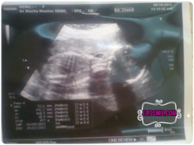 Scan 22 Minggu , Jantina Bayi dan Lai Chee Kang | Programmer by day ...