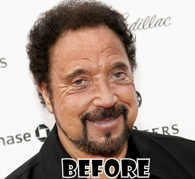 Celebrity Boob Jobs: Tom Jones Plastic Surgery Before and After Eyelid ...