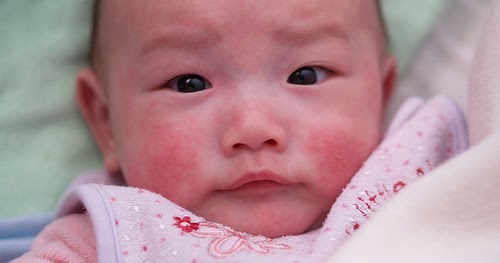 Go Go Healthy Everyone!: TESTIMONI RUAM BAYI DENGAN IKHTIAR SHAKLEE ...