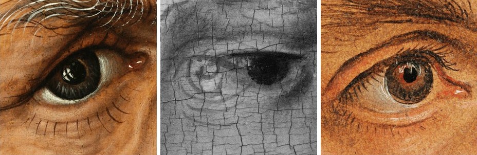 The Art & Science of Beauty : Double Eyelid Surgery