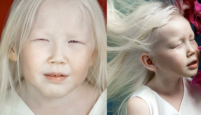White Wolf : 8-year-old Yakut albino indigenous girl surprises world ...