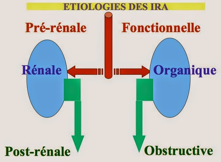 L'insuffisance rénale aigue | Récap' IDE