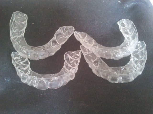 Cindy's kaakoperatie: Retentiebeugel: clear overlay of het spalkje?