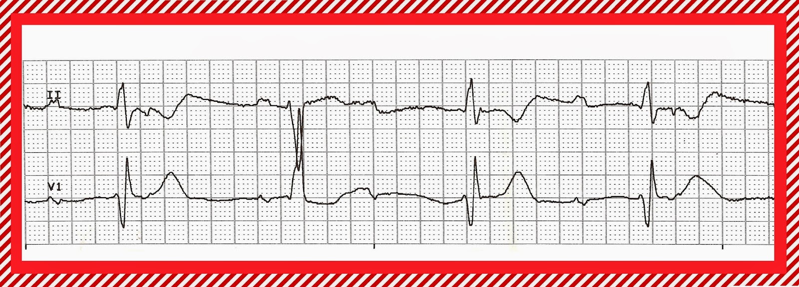 Practice EKG Strips Merry Christmas
