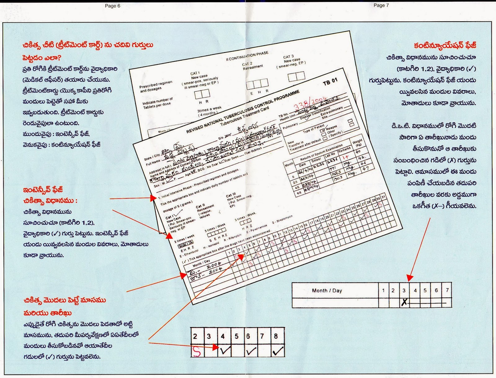 IEC MATERIAL FOR ALL NATIONAL HEALTH PROGRAMMES: TUBERCULOSIS DISEASE (TB)