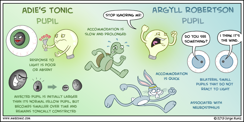 Adie's vs. Argyll Robertson pupil