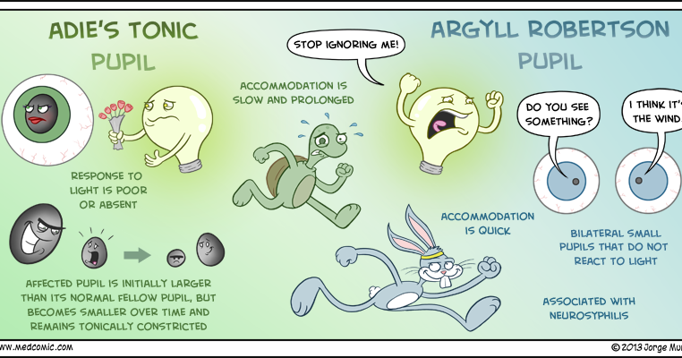 Adie's vs. Argyll Robertson pupil