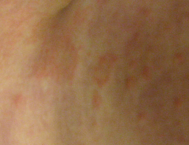 An Apel a Day: Sulfa I Hate You - Part 2