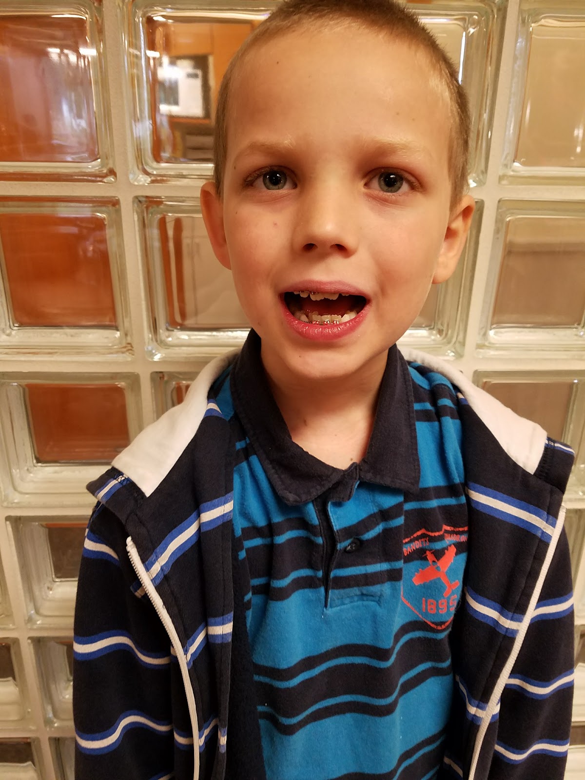 Our Beautiful Blessings!: Jack's Braces!