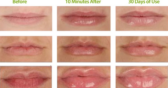 lip plumper before and after: best lips plumper 2013 Review