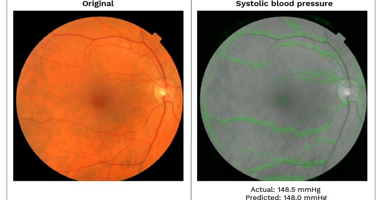 Data Data Data: DeepMind AI eyes ophthalmological test breakthrough