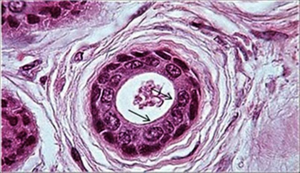 Plantão Médico: HISTOLOGÍA TEJIDO EPITELIAL DE REVESTIMIENTO Y GLANDULAR