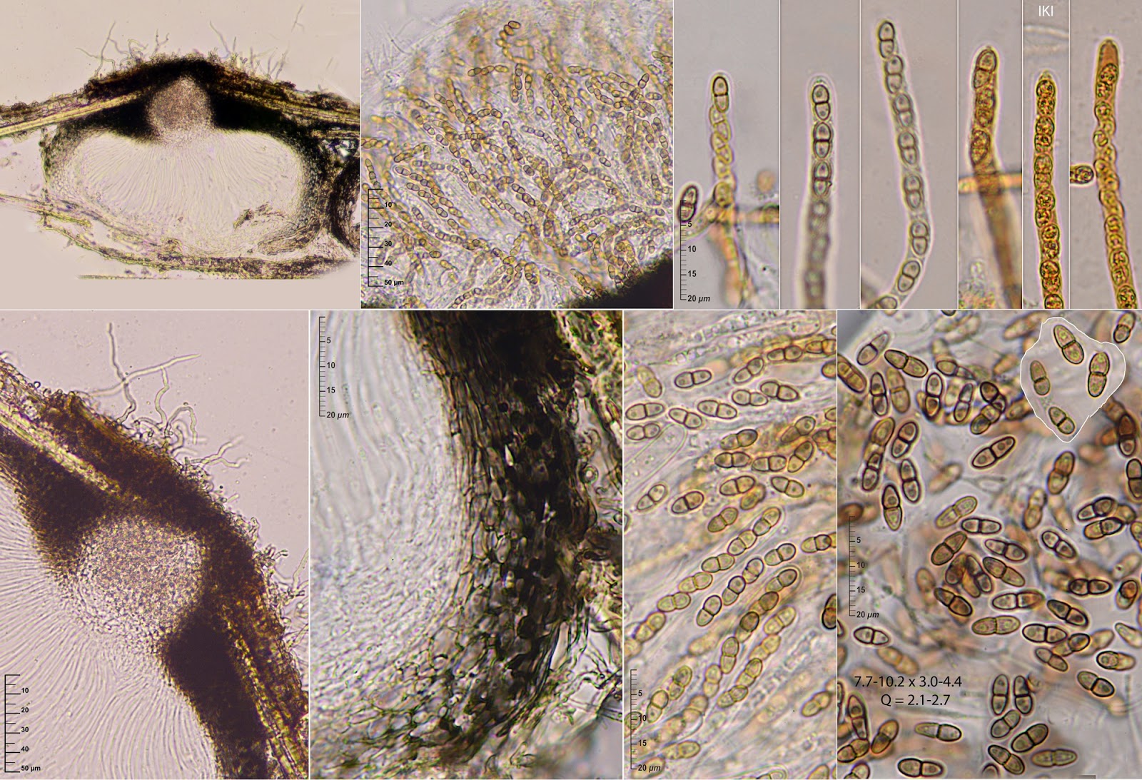 Rousoëlla donacicola (Speg.) Y.M. Ju, J.D. Rogers & Huhndorf • CEMAS