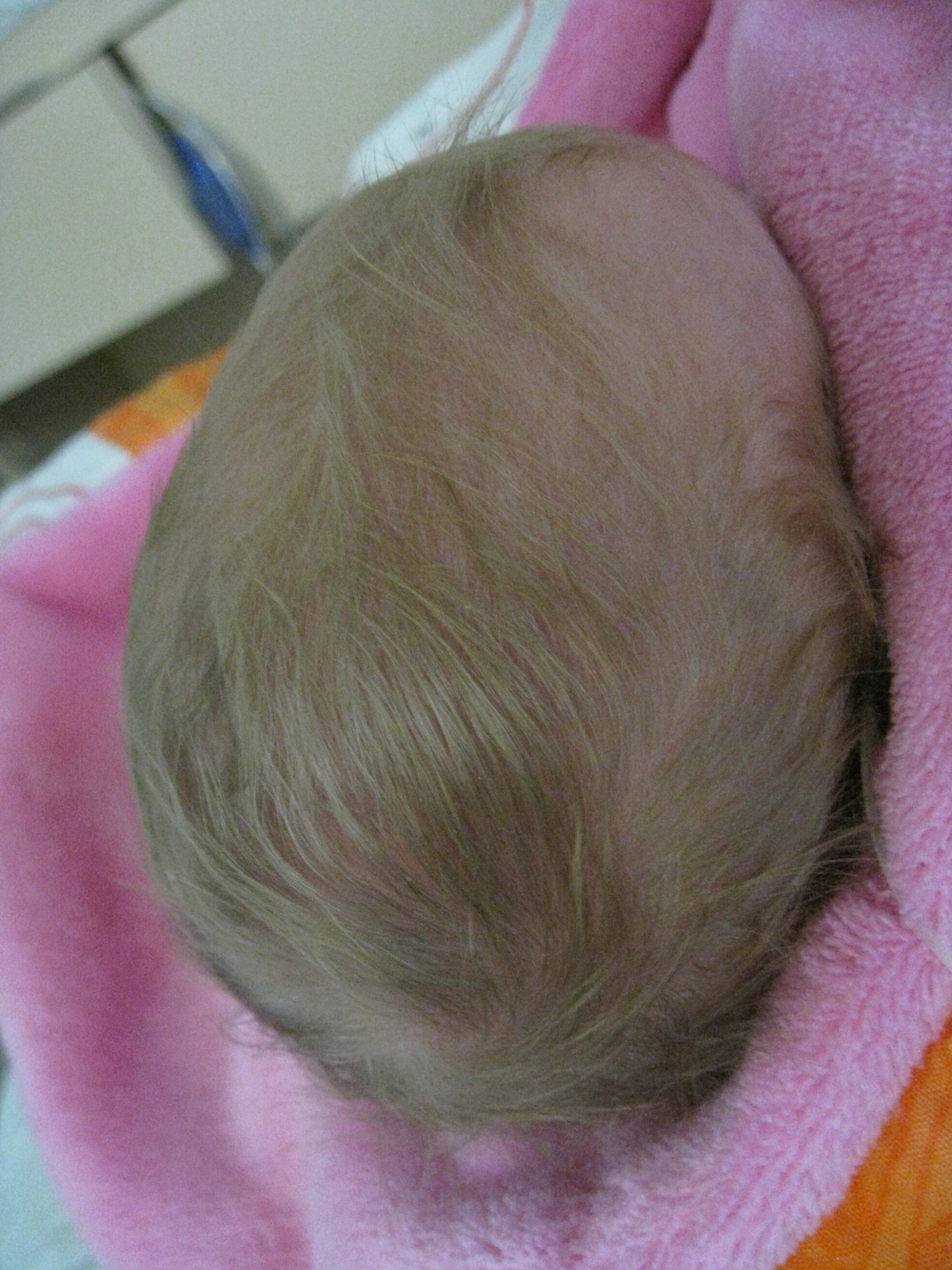 She Will Amaze You: Toaster Head Syndrome