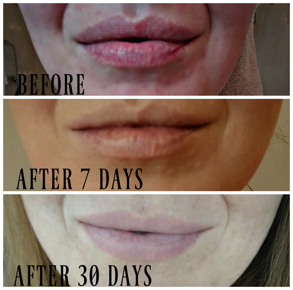 Hot Cookin' Mama: Redefine Lip Renewing Serum