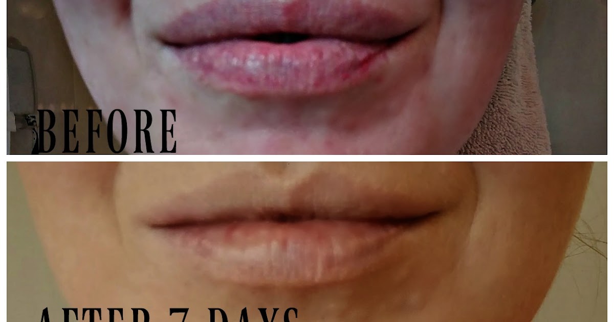 Hot Cookin' Mama: Redefine Lip Renewing Serum