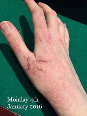 Hand-some | TSW Cara