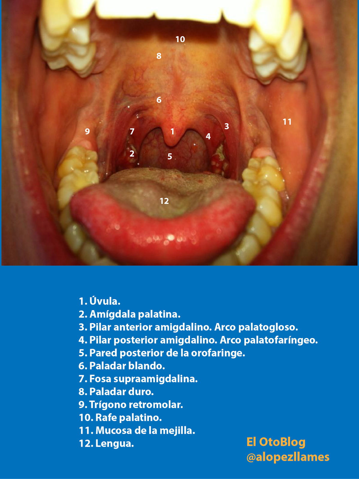 El OtoBlog: abril 2014