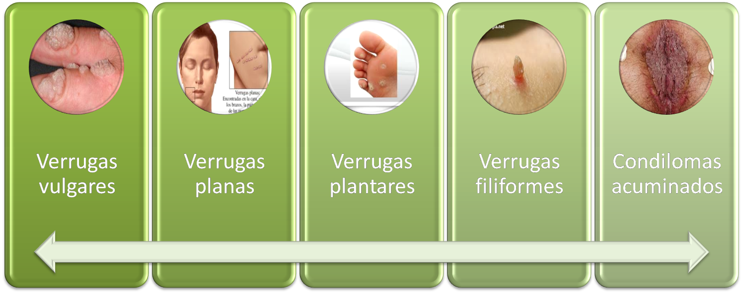 Dermatologia005: Las Virosis Cutáneas Grupo 1