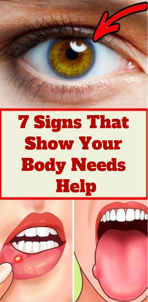 7 Signs That Show Your Body Needs Help