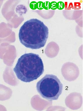 [Haematology] Normal Cells of the Blood and Hematopoietic Organs | Free ...