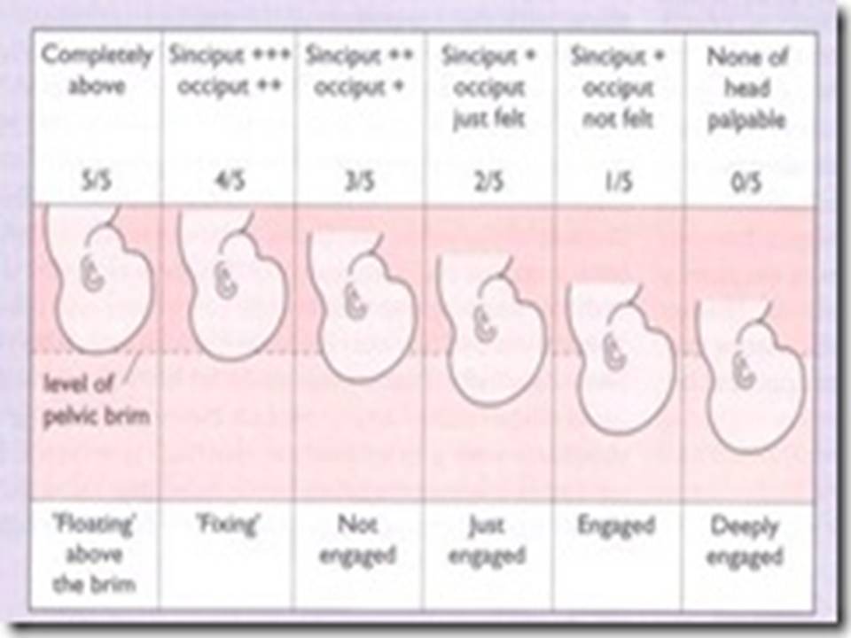 Distosia - Catatan Sugasetya