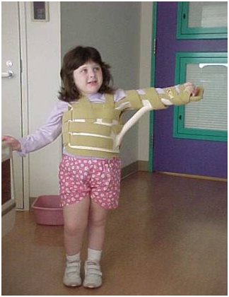 long life learning: Burn Injuries