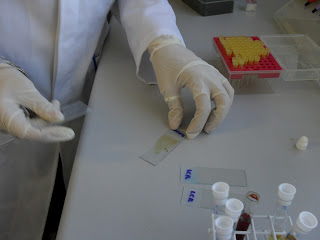 Citologia Clínica - 2011: LCR - Câmaras