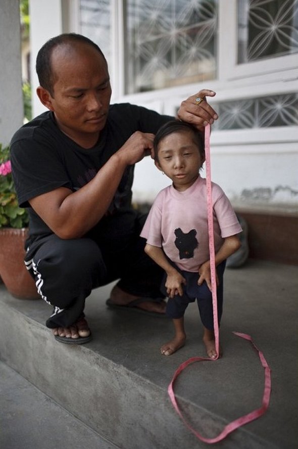 OMG World: OMG! Smallest Man In The World From Nepal