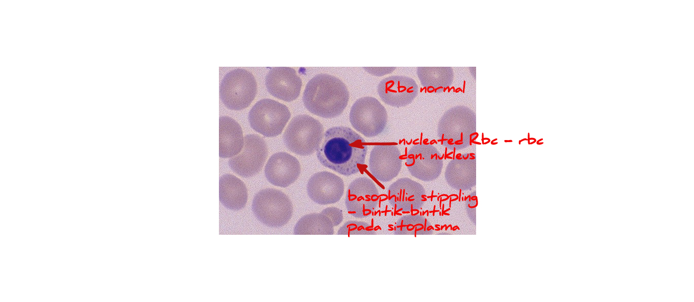 Blog Juruteknologi Makmal Perubatan @ MAD LAB BLOG: 06/01/2013 - 07/01/2013