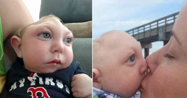 Get ready for surprise: He was born without a skull & his parents faced ...