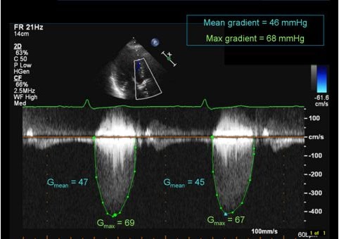 Phimaimedicine: พฤษภาคม 2011