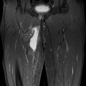 Sintonize na Radiologia: Ressonância Magnética
