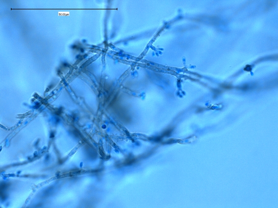 Fun With Microbiology (What's Buggin' You?): Fonsecaea pedrosoi/monophora
