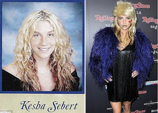 Kesha Plastic Surgery