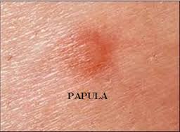 KosmetiikanKasvot: Kasvojen epäpuhtaudet