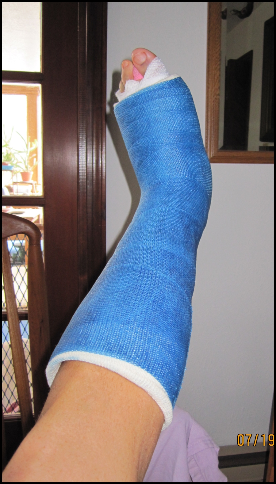 casts and feet (and more...)