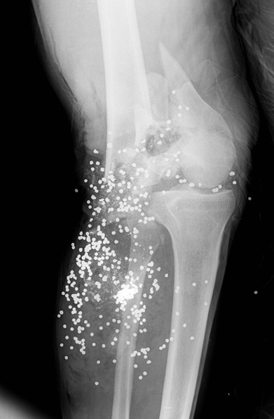 Emergence Phenomena: How to Find Foreign Bodies