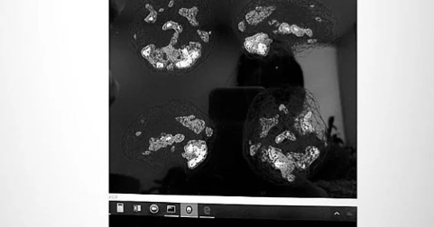 Wounded Times: Ariana Grande shares brain scan of PTSD to #BreakTheSilence