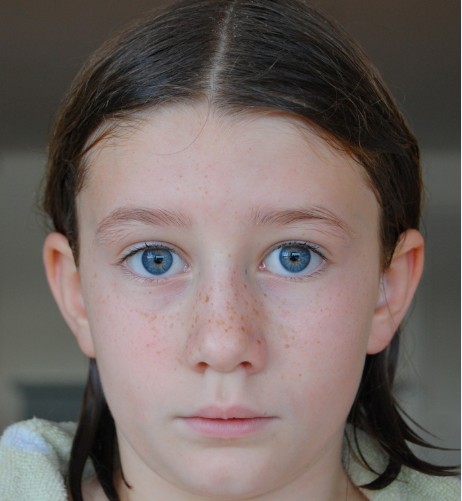 freckle on face: February 2013