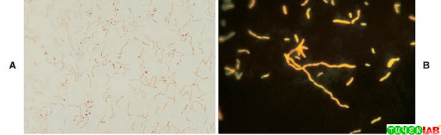 [Microbiology] Atlas of Vibrio, Aeromonas, Plesiomonas, and ...