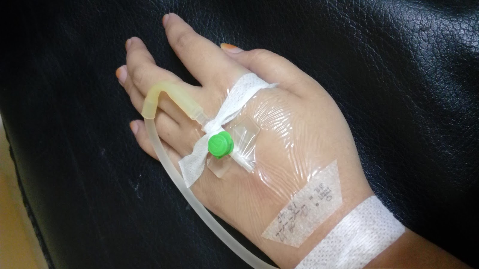 Pengalaman Operasi Kista Ovarium