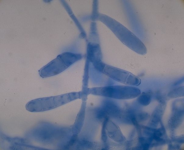 Microbiología y Epidemiología: Epidermophyton floccosum